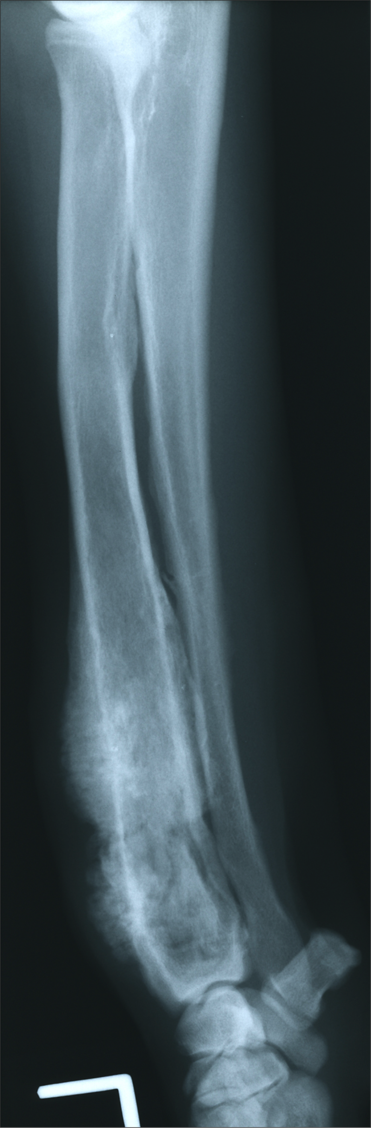 Osteosarcoma | What’s on the Horizon? | Animal Cancer Foundation
